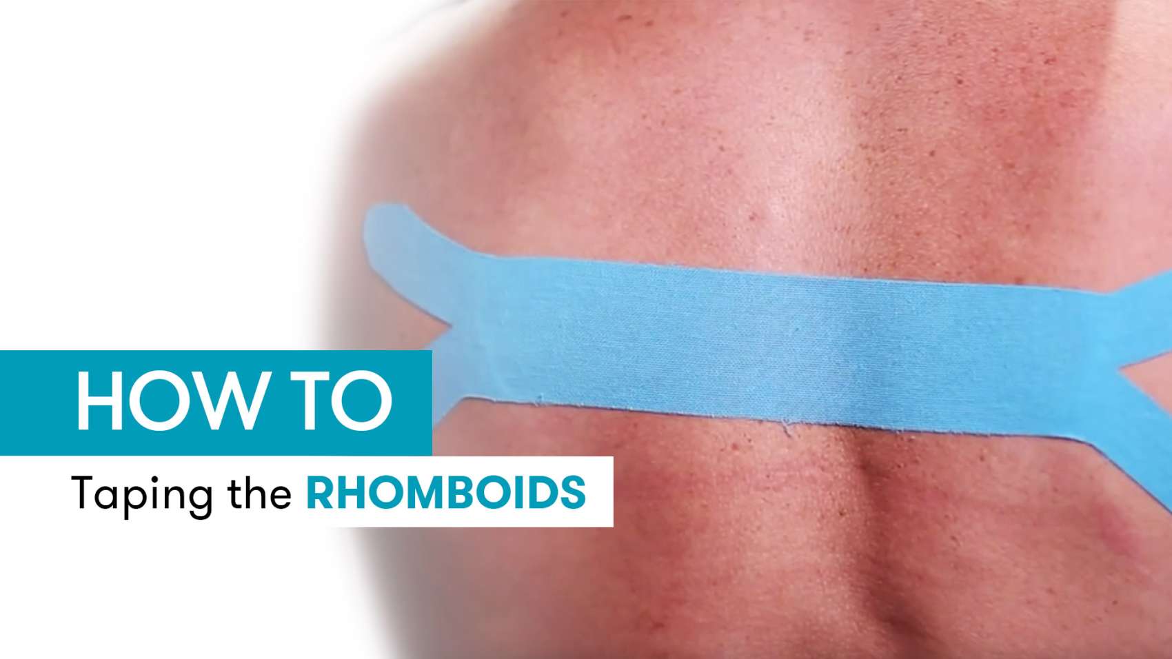 Rhomboids taping - Instructions with video